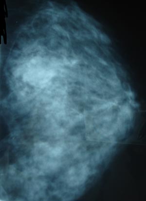 View Mammography 2 - The Doctors Platform